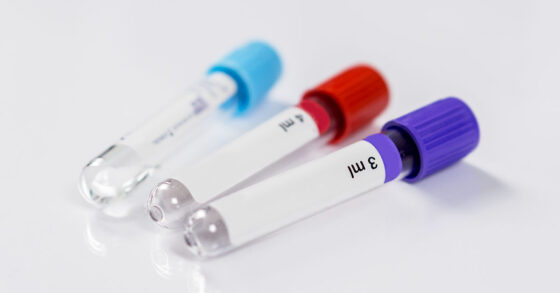 Reusable Tourniquet Alternative Provides Significant Waste Reduction